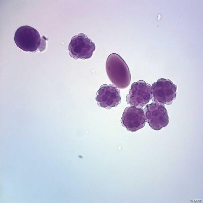 Carolina Biological Supply Company Cerebratulus Early Development, w.m ...