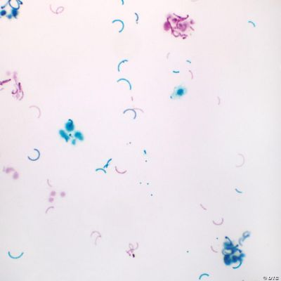 Carolina Biological Supply Company Water Bloom (Wasserbluthe), w.m ...