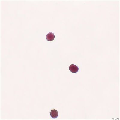 Carolina Biological Supply Company Starfish Fertilized, w.m. Microscope ...